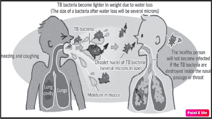Tuberculosis: "The captain of all these men of death” - The Standard ...